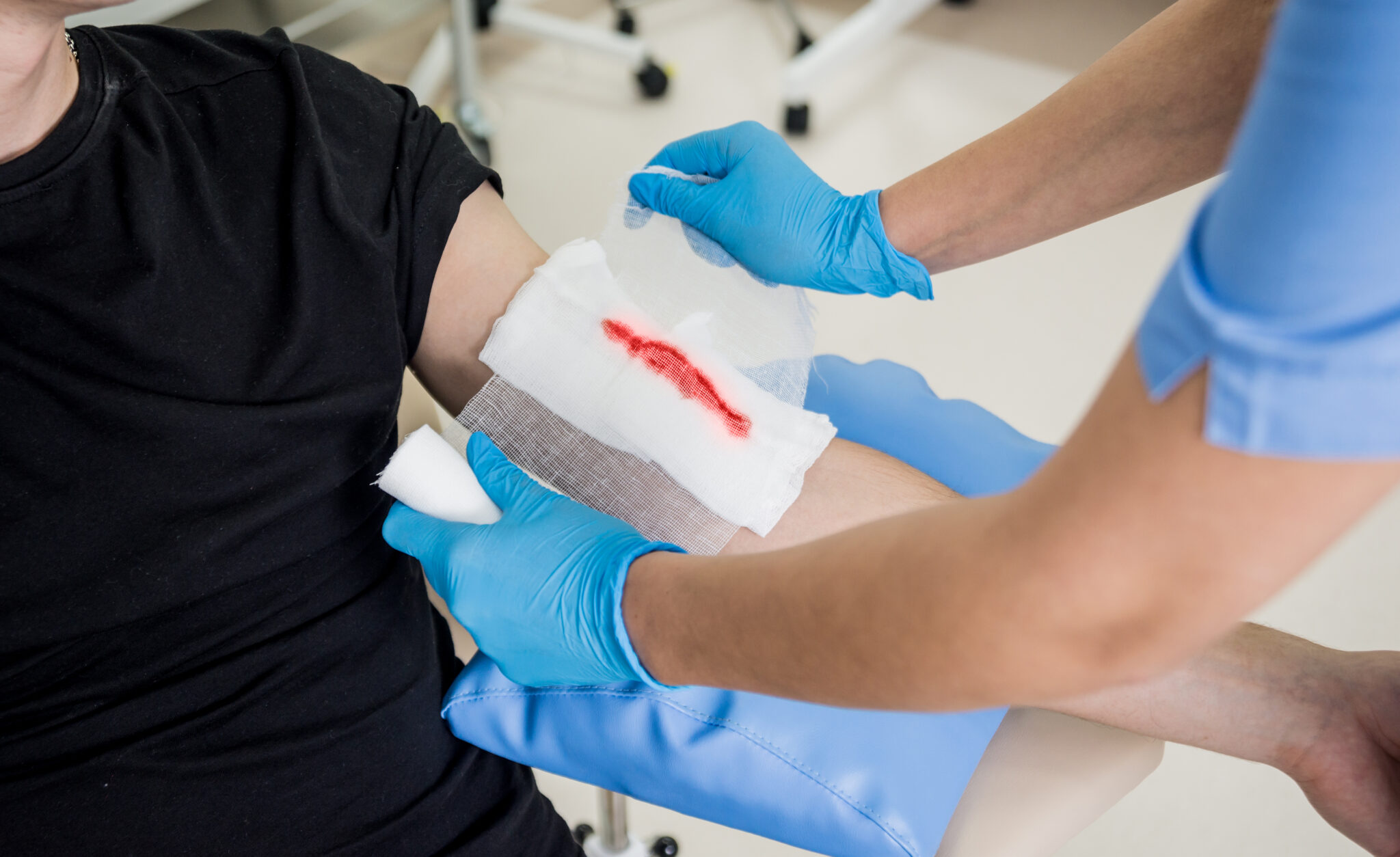 Severe Lacerations from Miami Car Accidents - Dolan Dobrinsky Rosenblum ...